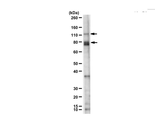 Anti-Tau (T22), oligomeric Antibody | ABN454